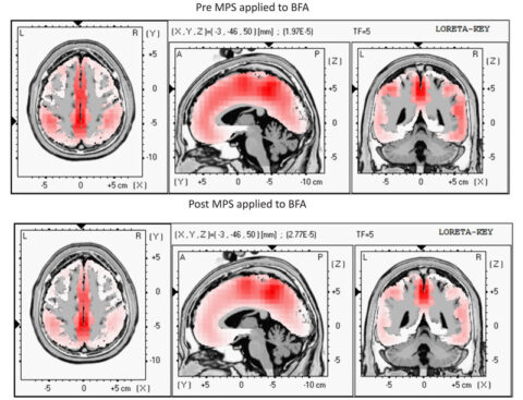 Manual Osteopathy and Deep Tissue Massage Calgary from Orthosports ...